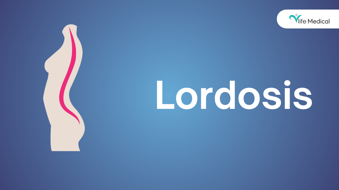 Ketahui Perbedaan Lordosis, Kifosis, Dan Skoliosis - Vlife Medical